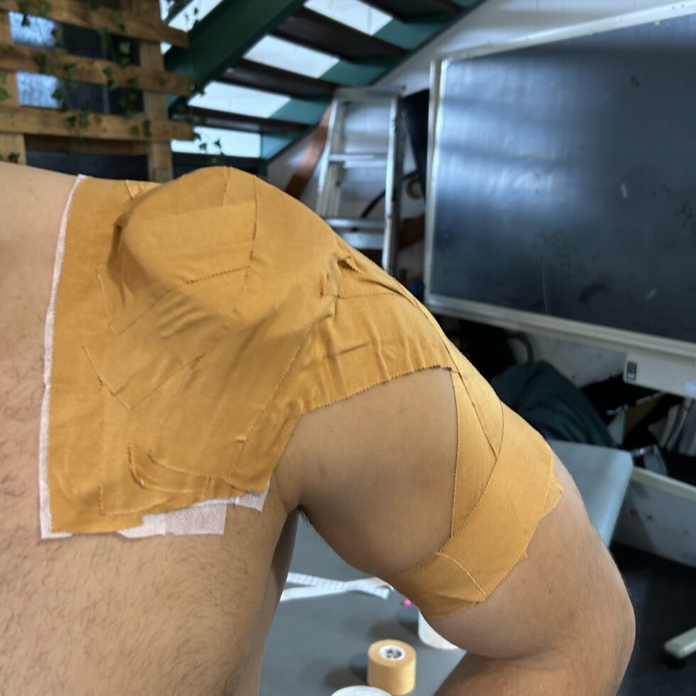 The Most Common Rugby Injuries We See: Prevention, Treatment, and ...